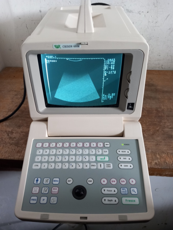 Extra medicinski monitor ultrazvuk ultra zvuk aparat CHISON 600M ...